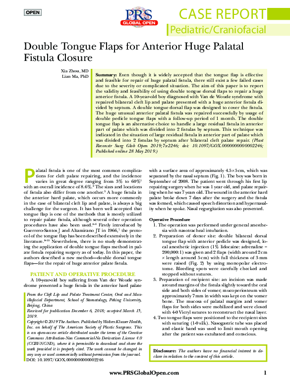 (PDF) Double Tongue Flaps for Anterior Huge Palatal Fistula Closure