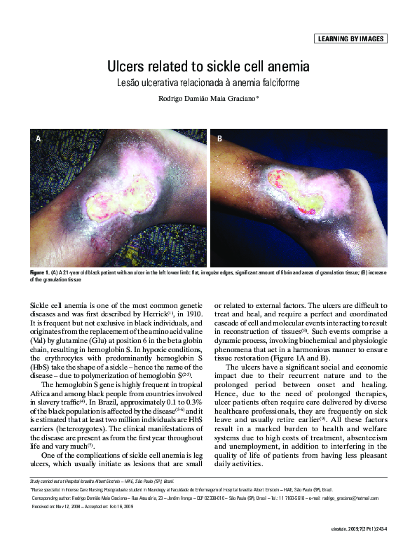 (PDF) Ulcers related to sickle cell anemia | Rodrigo Graciano ...