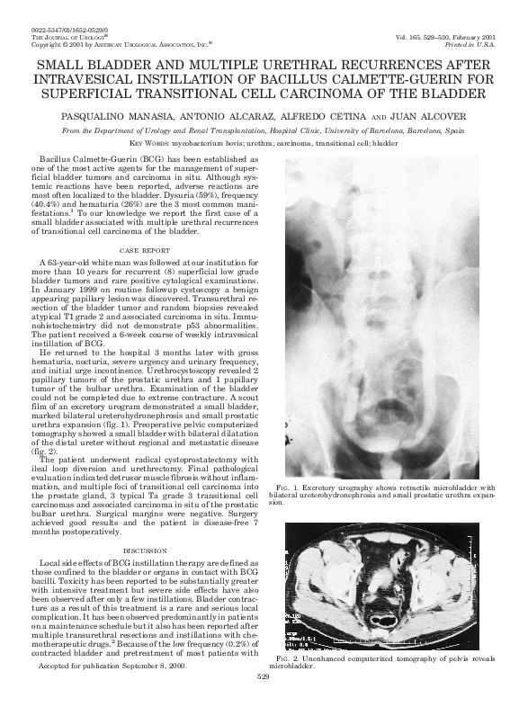 (PDF) Small Bladder and Multiple Urethral Recurrences After ...