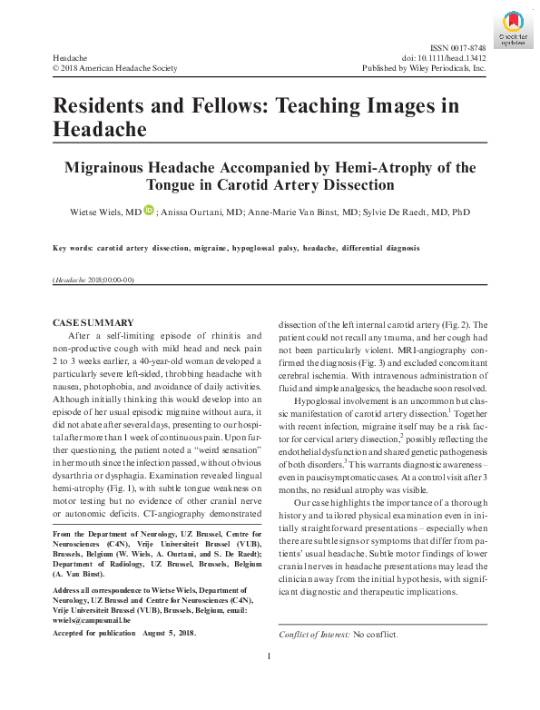 (PDF) Migrainous Headache Accompanied by Hemi-Atrophy of the Tongue in ...
