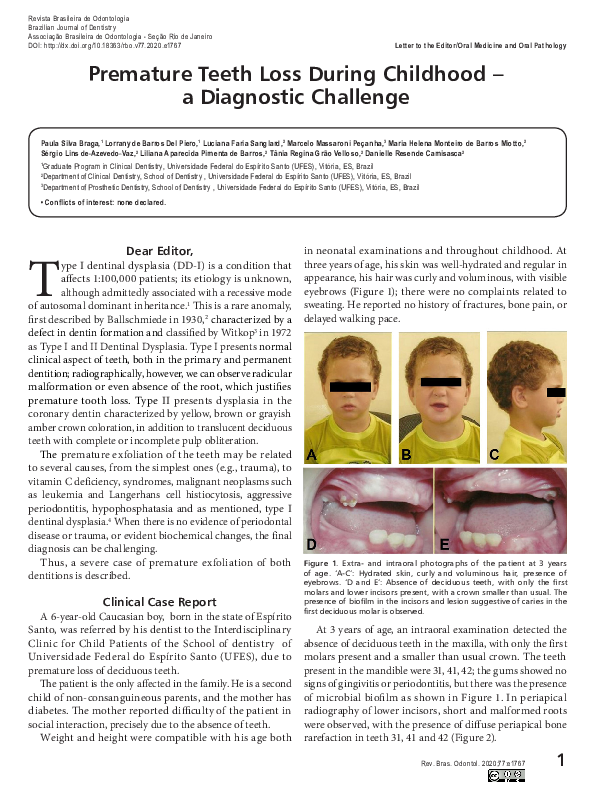 (PDF) Premature Teeth Loss During Childhood – a Diagnostic Challenge