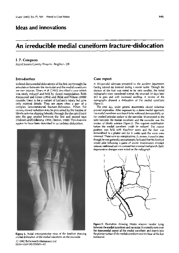 (PDF) An irreducible medial cuneiform fracture-dislocation