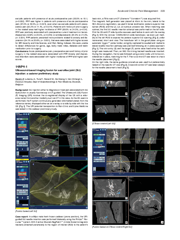 (PDF) Ultrasound-based imaging fusion for sacroiliac joint (SIJ) injection: a cadaver ...