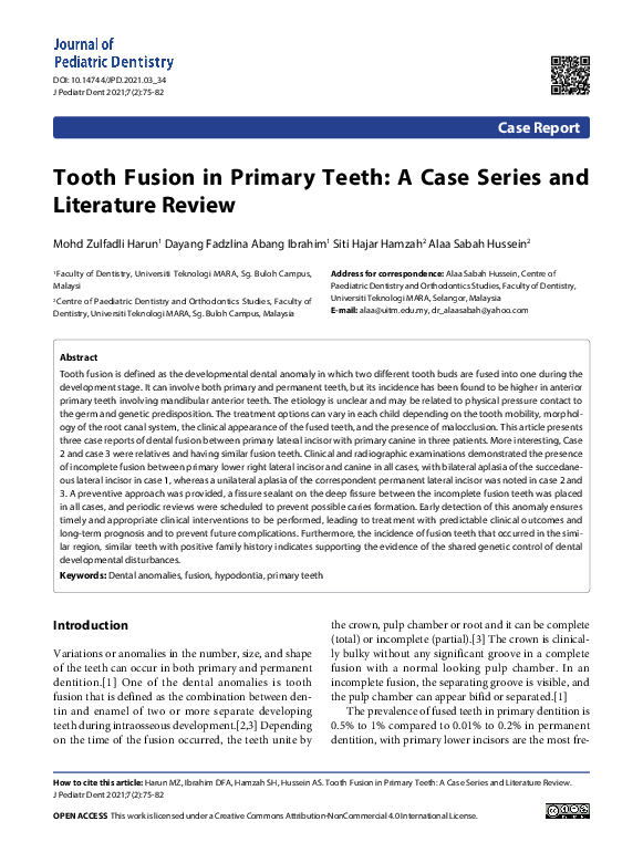 (PDF) Tooth Fusion in Primary Teeth: A Case Series and Literature Review