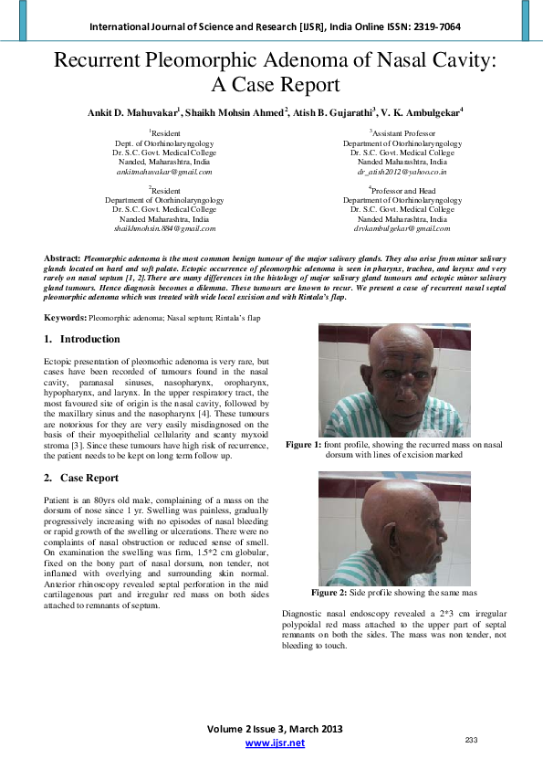(PDF) Recurrent Pleomorphic Adenoma of Nasal Cavity: A Case Report