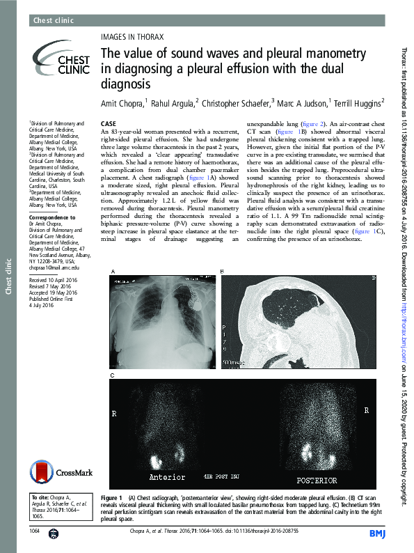 (PDF) The value of sound waves and pleural manometry in diagnosing a ...