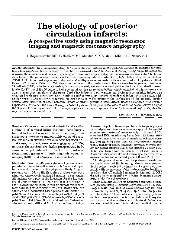 (PDF) Posterior circulation ischaemic stroke | Gargi Banerjee ...