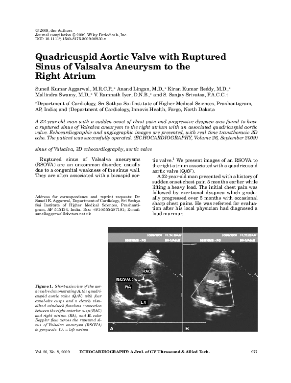 (PDF) Quadricuspid Aortic Valve with Ruptured Sinus of Valsalva ...