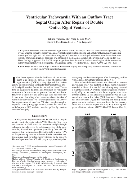(PDF) Ventricular Tachycardia With an Outflow Tract Septal Origin After ...