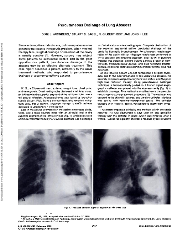 (PDF) Percutaneous drainage of lung abscess