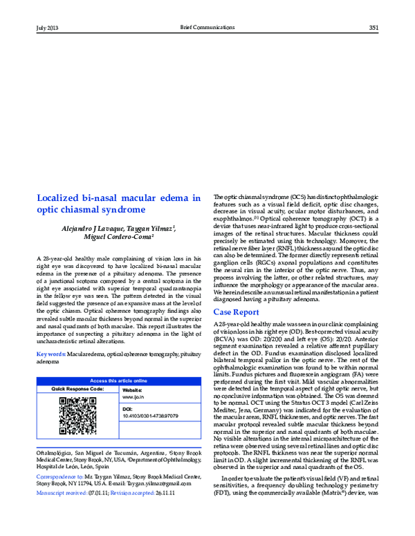 (PDF) Localized bi-nasal macular edema in optic chiasmal syndrome