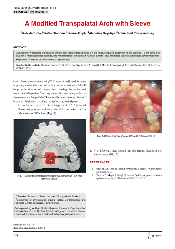 (PDF) A Modified Transpalatal Arch with Sleeve | Ashish Gupta ...