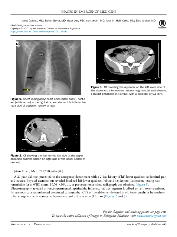 (PDF) Male With Left Lower Quadrant Pain | Tayfun Borta - Academia.edu
