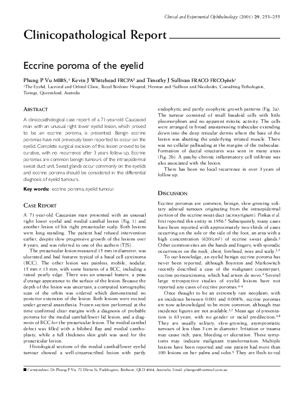 (PDF) Eccrine poroma of the eyelid | Phung Vu - Academia.edu