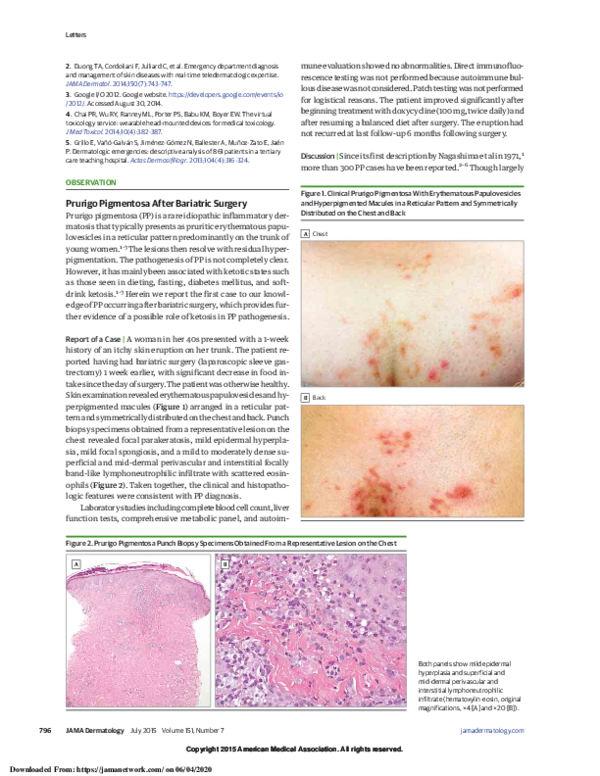 (PDF) Prurigo Pigmentosa After Bariatric Surgery