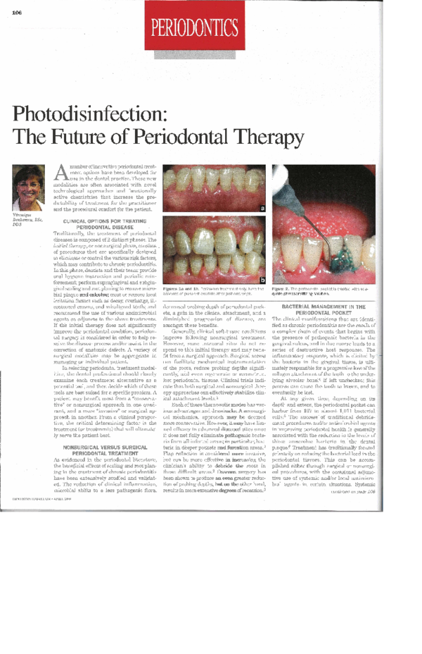 (PDF) Photodisinfection: the future of periodontal therapy