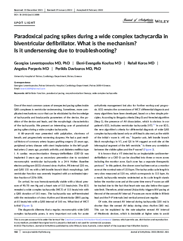 Pdf Paradoxical Pacing Spikes During A Wide Complex Tachycardia In