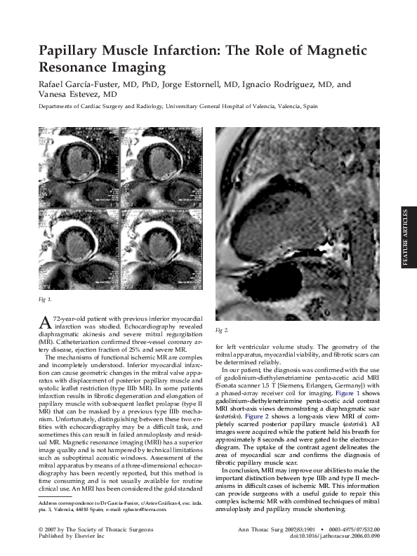 (PDF) Papillary Muscle Infarction: The Role of Magnetic Resonance Imaging