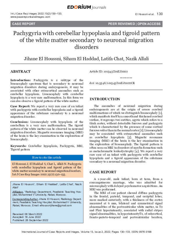 (PDF) Pachygyria with cerebellar hypoplasia and tigroid pattern of the ...