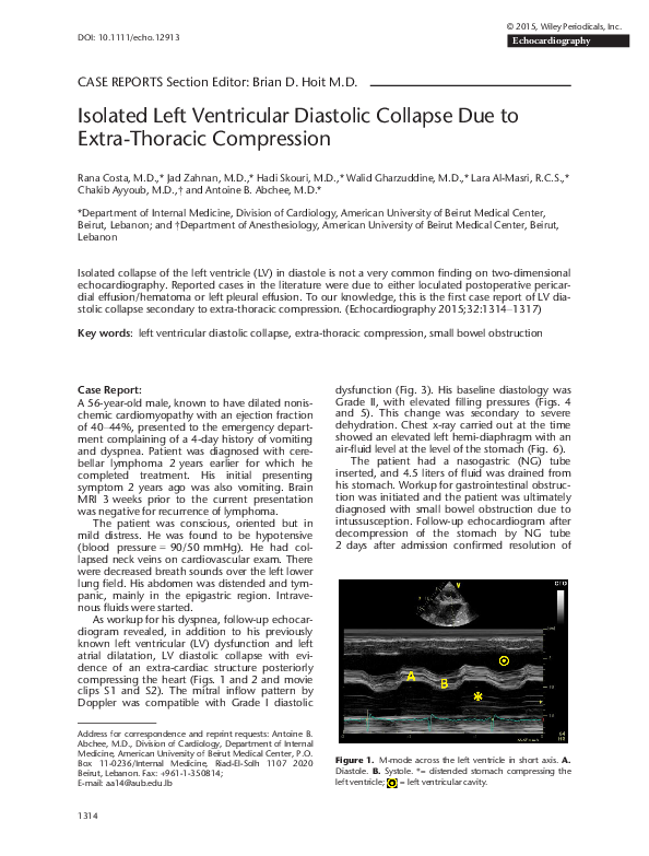 (PDF) Isolated left ventricular diastolic collapse in pericardial ...