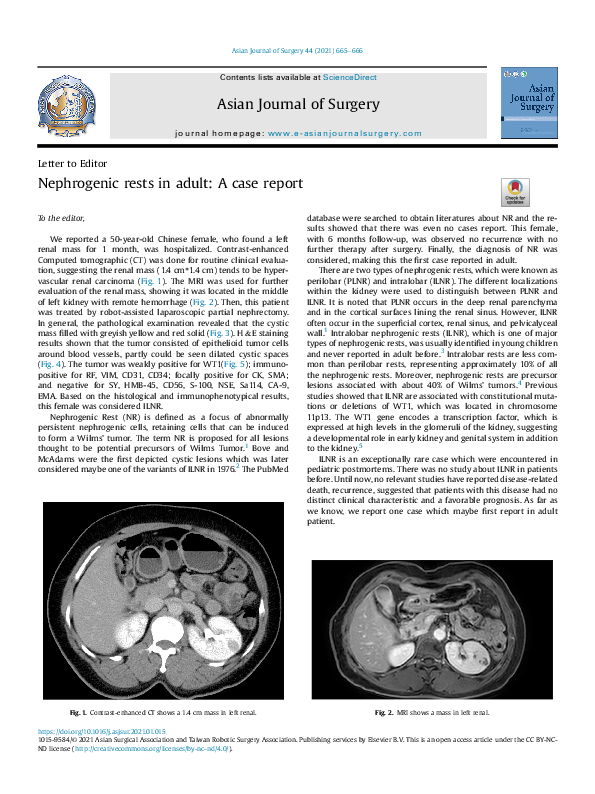 (PDF) Nephrogenic rests in adult: Case report