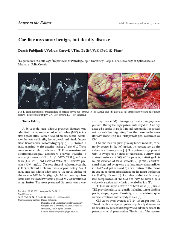 (PDF) Peritendinous effusion of the flexor hallucis longus tendon as a ...