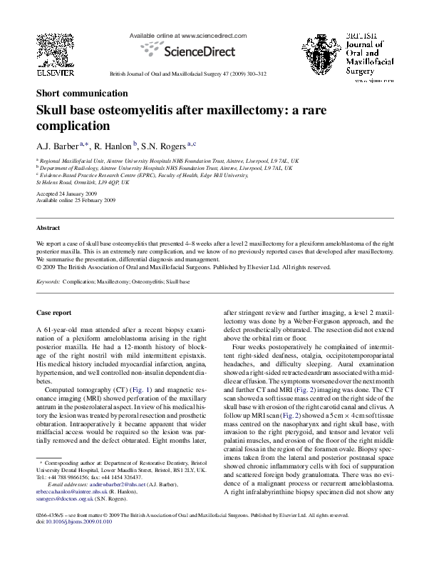 Pdf Skull Base Osteomyelitis After Maxillectomy A Rare Complication