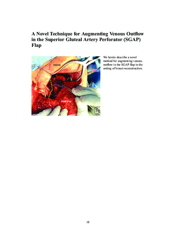 (PDF) A Novel Technique for Augmenting Venous Outflow in the Superior ...