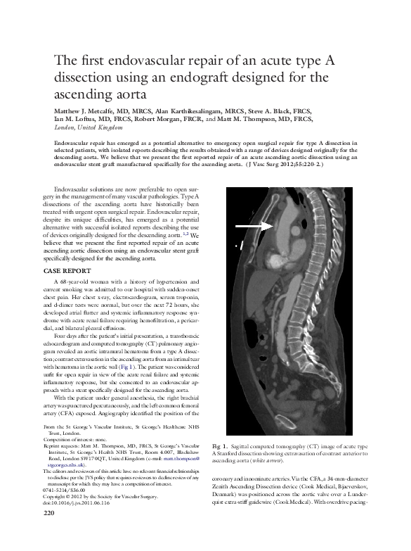 (PDF) The first endovascular repair of an acute type A dissection using ...