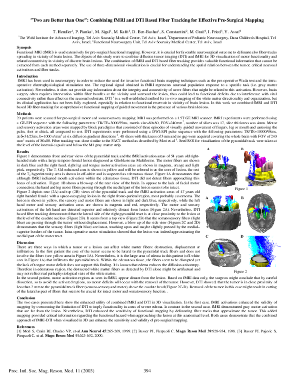 (PDF) Two are better than one : combining fMRI and DTI based fiber ...
