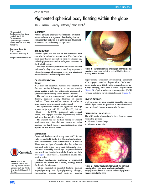 (PDF) Pigmented spherical body floating within the globe