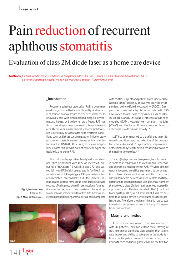 (PDF) Pain reduction of recurrent aphthous stomatitis, evaluation of class 2M diode laser as a ...