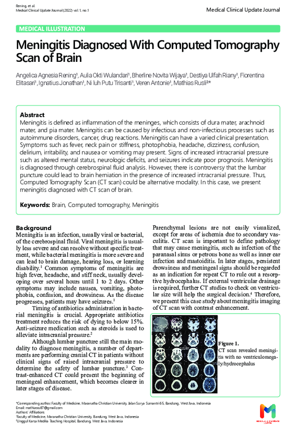 (PDF) Meningitis Diagnosed With Computed Tomography Scan of Brain