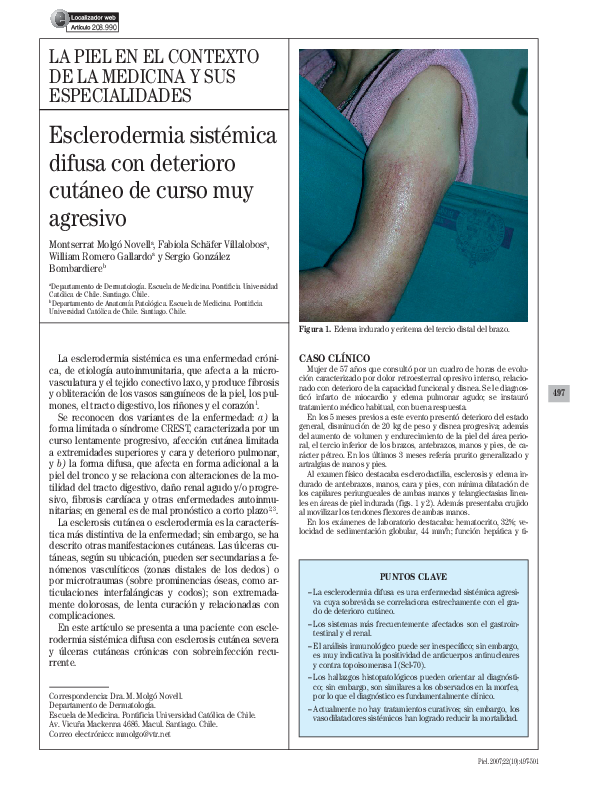 (PDF) Esclerodermia sistémica difusa con deterioro cutáneo de curso muy ...