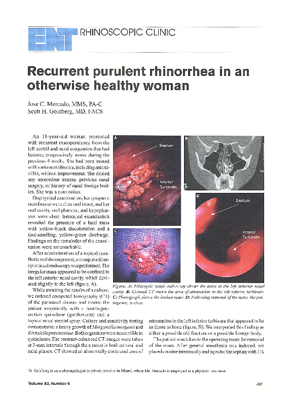 (PDF) Recurrent Purulent Rhinorrhea in an otherwise Healthy Woman ...