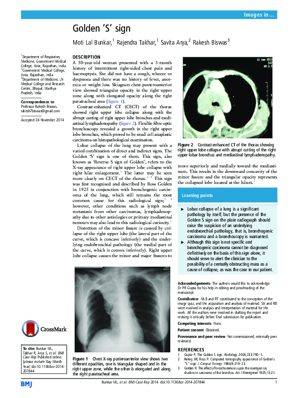 (PDF) Golden 'S' sign