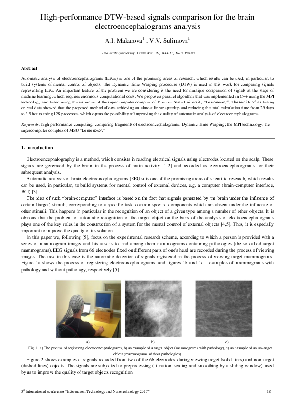 (PDF) High-performance DTW-based signals comparison for the brain electroencephalograms analysis
