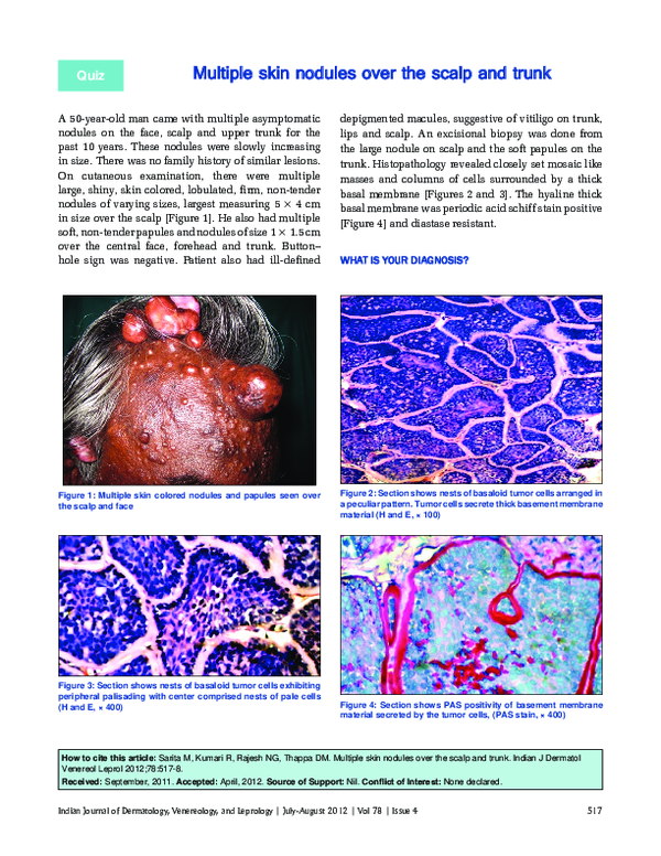 (PDF) Multiple skin nodules over the scalp and trunk