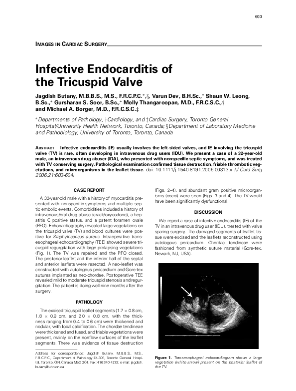 (PDF) Infective Endocarditis of the Tricuspid Valve | Varun Dev ...