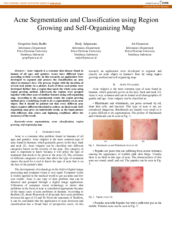 (PDF) Acne Segmentation and Classification using Region Growing and Self-Organizing Map | Ari ...