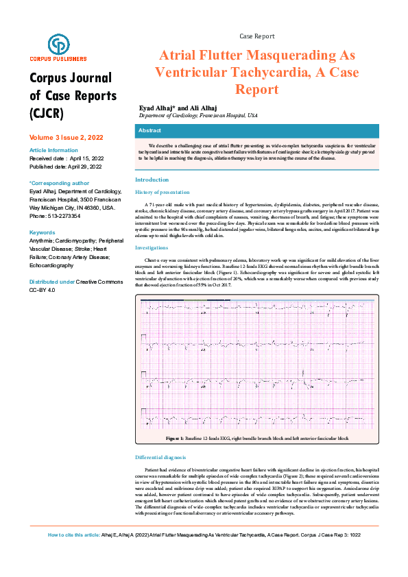 (PDF) Atrial Flutter Masquerading As Ventricular Tachycardia, A Case Report