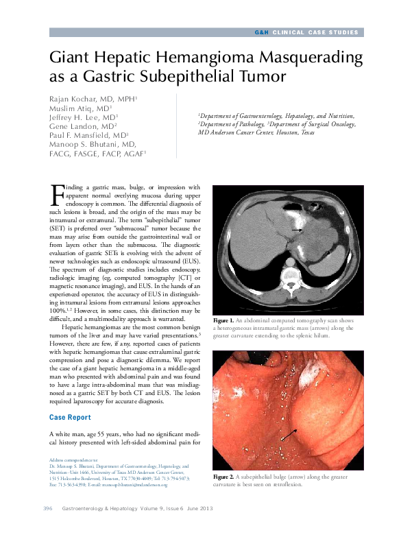 (PDF) Giant hepatic hemangioma masquerading as a gastric subepithelial ...