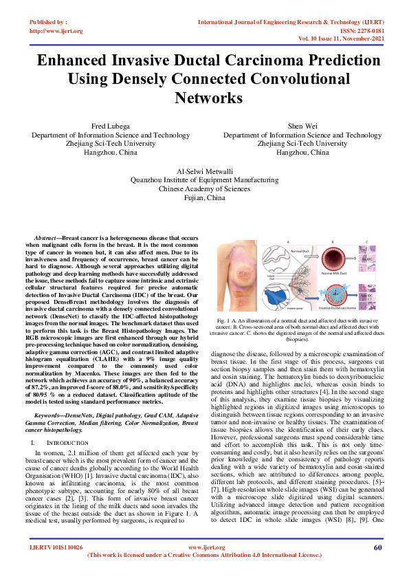 Pdf Enhanced Invasive Ductal Carcinoma Prediction Using Densely Connected Convolutional