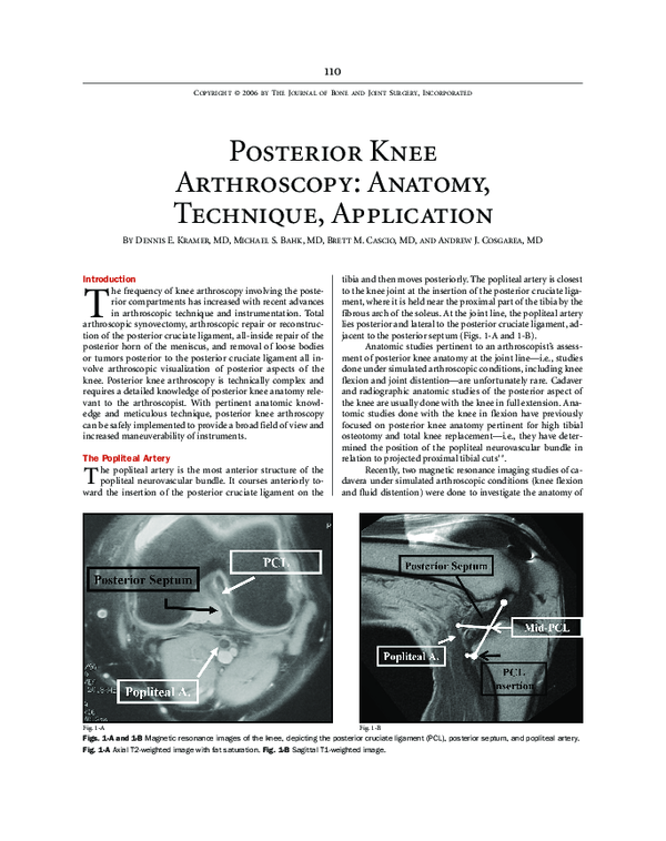 (PDF) Posterior Knee Arthroscopy: Anatomy, Technique, Application | Andrew Cosgarea - Academia.edu