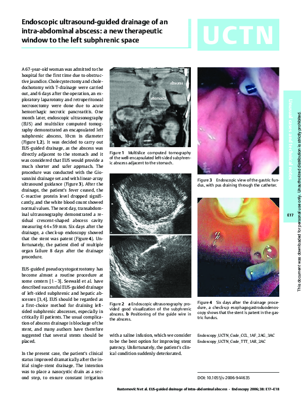 (PDF) Endoscopic ultrasound-guided drainage of an intra-abdominal ...