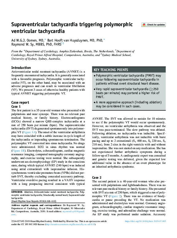 (PDF) Supraventricular tachycardia triggering polymorphic ventricular ...