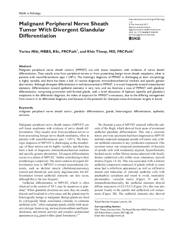 (PDF) Malignant peripheral nerve sheath tumor with divergent ...