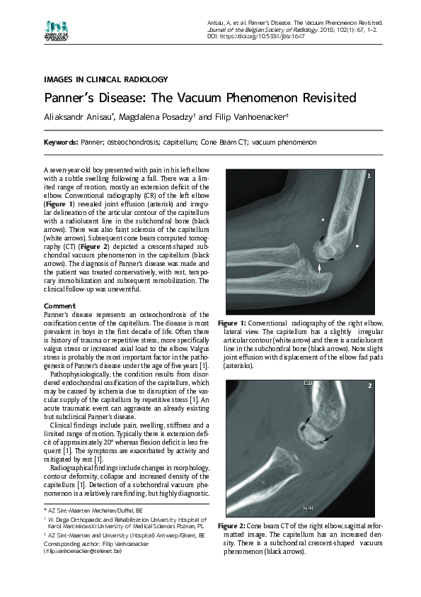 (PDF) Panner’s Disease: The Vacuum Phenomenon Revisited