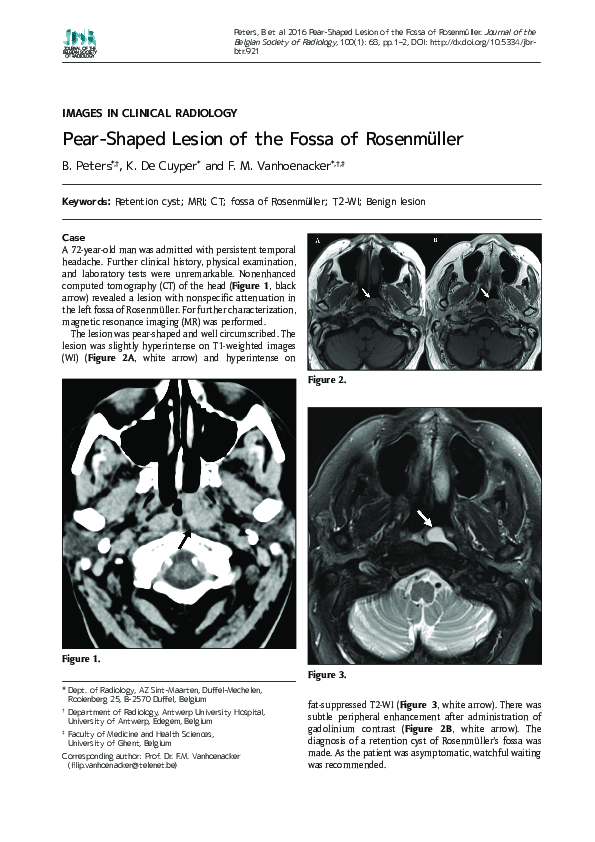 (PDF) Images in clinical radiology : pear-shaped lesion of the fossa of ...