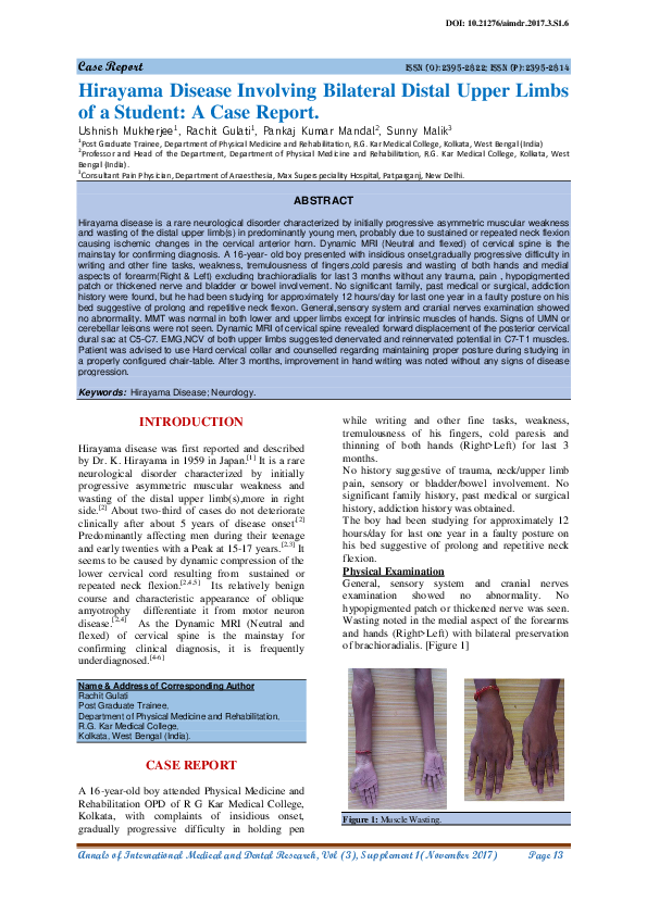 (PDF) Hirayama Disease Involving Bilateral Distal Upper Limbs of a ...